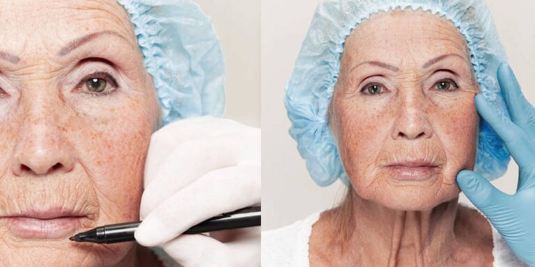 Hilos tensores. Usos y Beneficios | Movidatuy.com