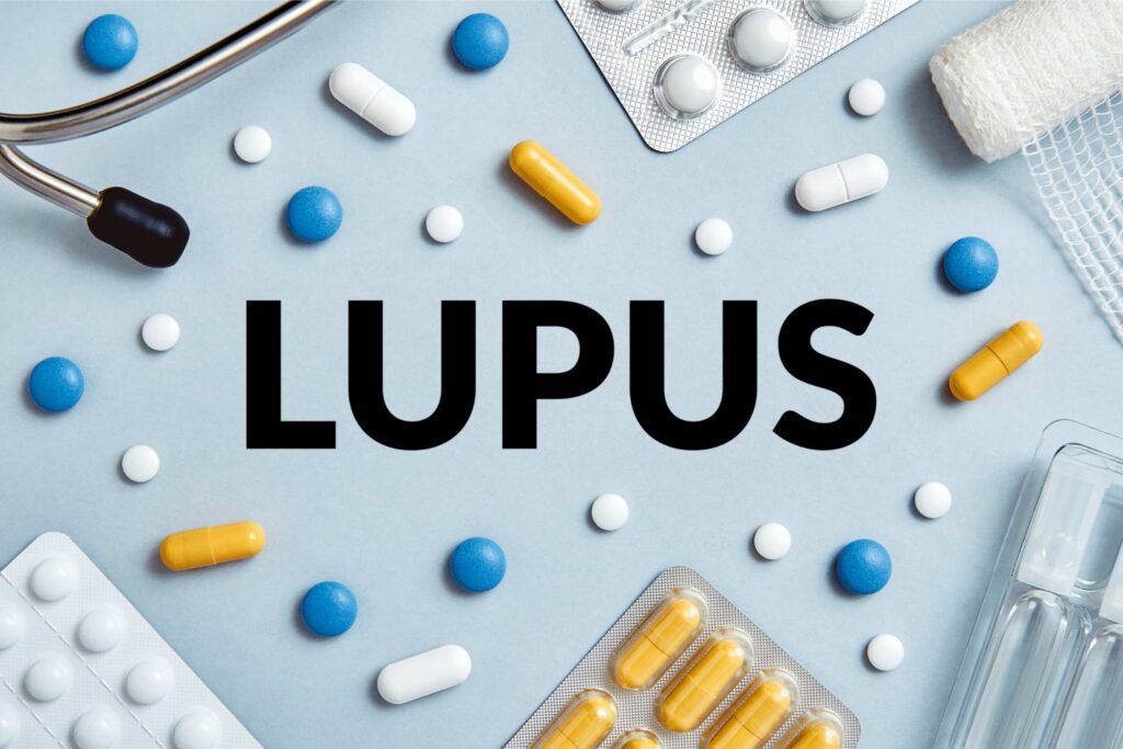 Lupus ¿Qué es y cómo se trata la enfermedad? | Movidatuy.com